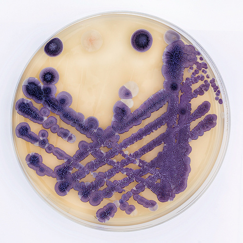 In my lab, we call this "project purple rain" | Experiment